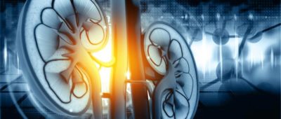 Leibovich score - Action Kidney Cancer